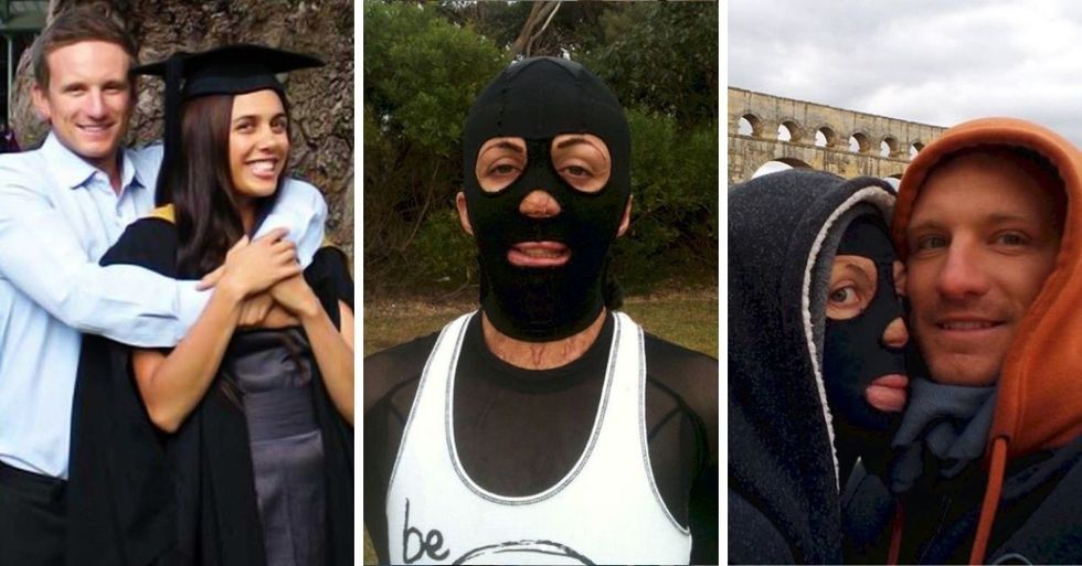 Turia Pitt Reveals Her Powerful Story of True Love After Surviving ...